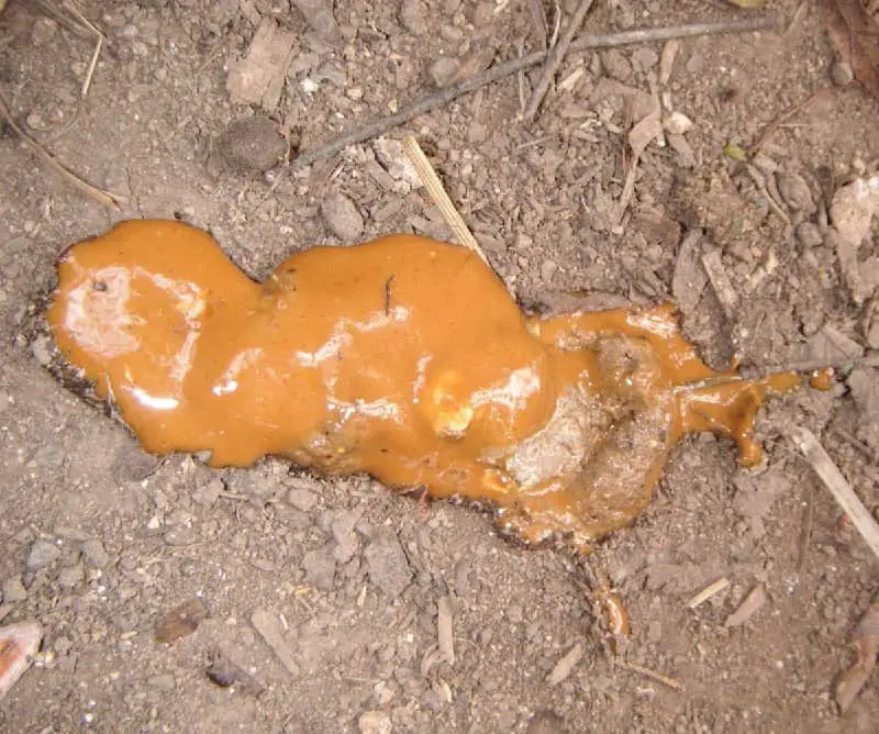 ¿Qué es normal y qué no? - Pol y Edro